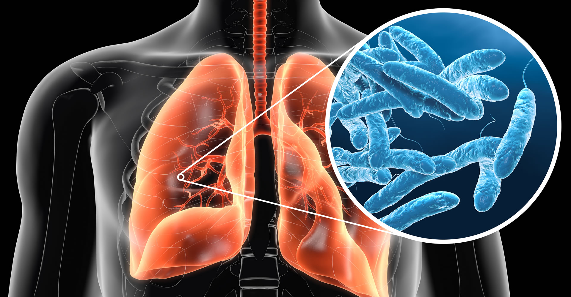 Level 3 Legionella Control for Responsible Persons (RQF) - Rock Compliance